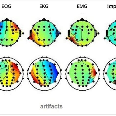 Example Of A Complete Ic Set Of 25 Topoplots With One Experts Labeling Download Scientific