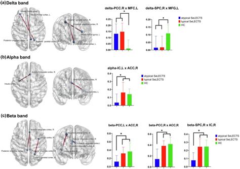 Combination Of Magnetoencephalographic And Clinical Features To Identify Atypical Self Limited