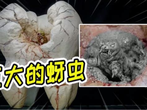 牙齿里蚜虫的图片一颗文秘苑图库