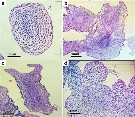 Histology Of Somatic Embryos Showing Different Stages A Post Globular Download Scientific