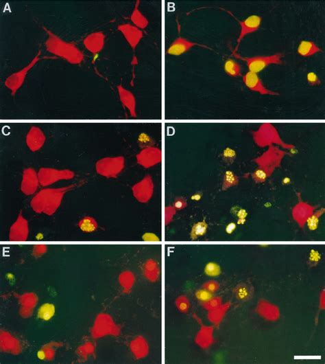 In Situ Dna Fragmentation Detected By The Tunel Technique Cells Were