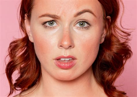 Red Blotchy Skin On Face What It Is And How To Get Rid Of It