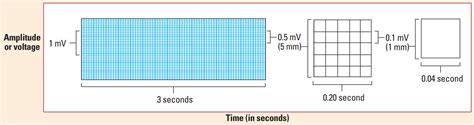 Medicowesome Mnemonics And Basics Of Ecg Interpretation