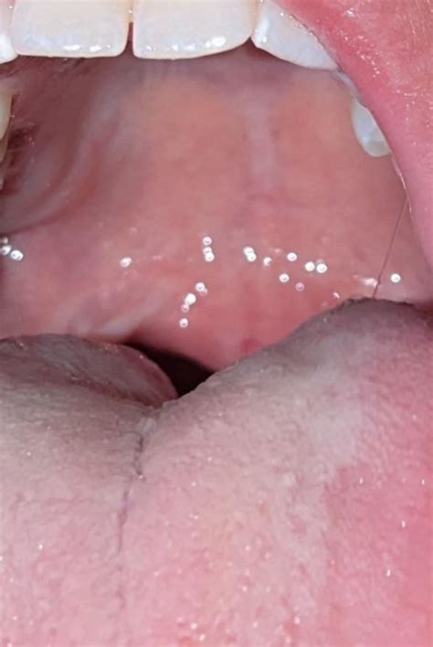 Are These Bruises Signs Of Oral Sex Or Something Else Just Noticed Them