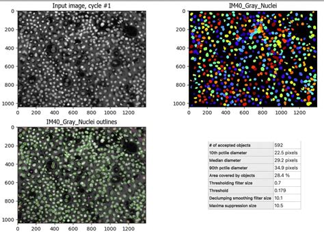 Problems Identifying Cell Boundaries And Cells Properly Image Analysis Imagesc Forum