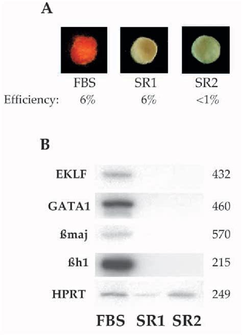 Figure 1 From The Bmpbmprsmad Pathway Directs Expression Of The