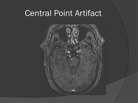 Ppt Mri Artifacts Powerpoint Presentation Free Download Id2153316