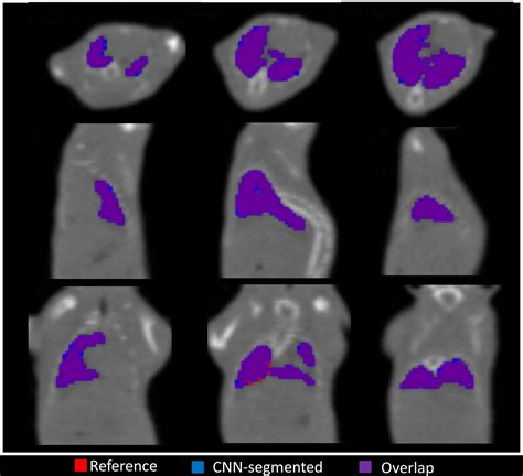 Deep Learning Based Automatic Lung Segmentation On Multiresolution Ct Scans From Healthy And