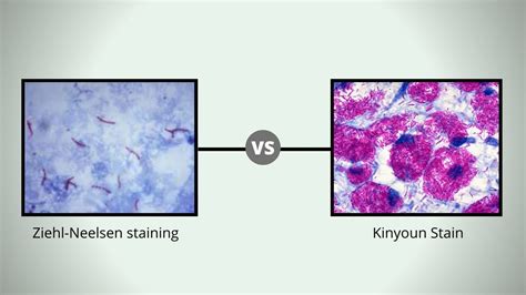 Ziehl Neelsen Stain Archives Biology Notes Online
