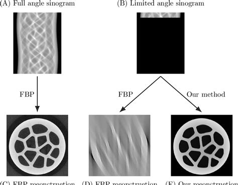 Figure 1 From Limited Angle Tomography Reconstruction Via Deep End To End Learning On Synthetic