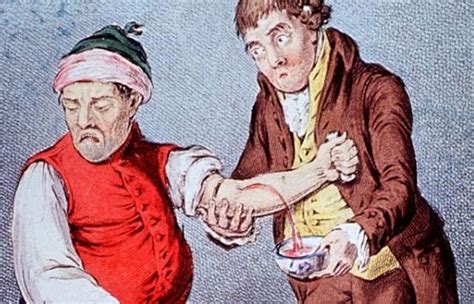 10 უძველესი სამედიცინო პრაქტიკა რომელიც სისხლს გაგიყინავთ სასარგებლო რჩევები