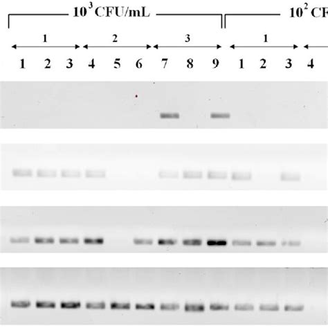 Optimization Of Dna Extraction Protocol S Aureus Dna Fragment