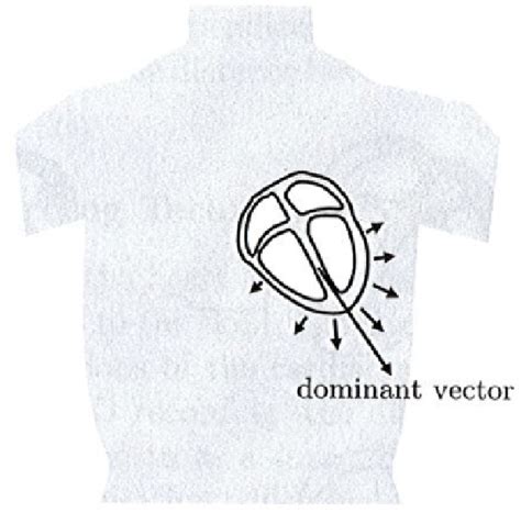 Figure 2 1 From Modeling Of The Atrioventricular Node During Atrial Fibrillation To Non