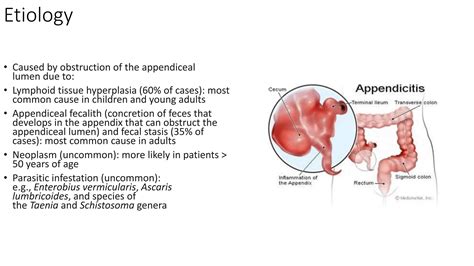 Classification Of Acute Appendicitis Pptx