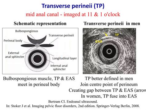 Endoanal Ultrasound In Anal Diseases Pptx