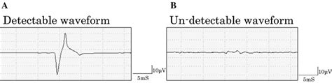 A Detectable Waveform B Undetectable Waveform Download Scientific Diagram