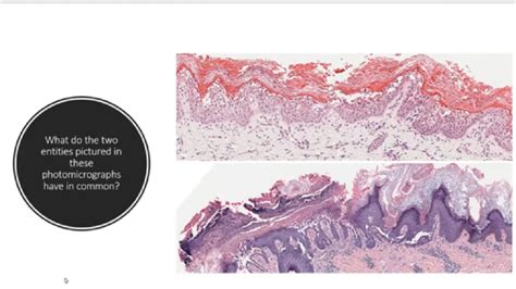 Epidermal Reaction Patterns Sagis