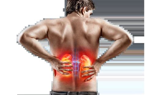 سنگ کلیه علائم، نشانه ها، روش تشخیص و درمان