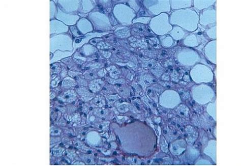 Adipose Tissue Types Functions Structure And Location Jotscroll