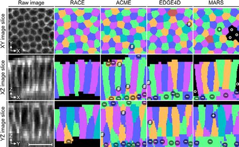 Real Time Three Dimensional Cell Segmentation In Large Scale Microscopy Data Of Developing