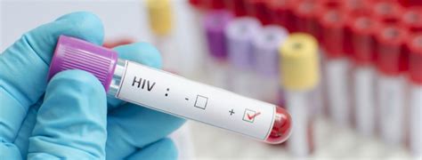 Вакцина против ВИЧ испытание эффективности на 2600 пациентах