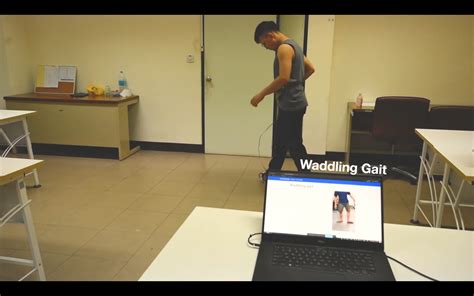 Iot Based Wearable Device Offers Affordable And Portable Gait Analysis