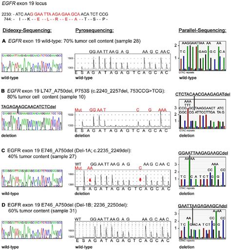 Egfr Exon 19 Mutation Analysis In Nsclc Tumor Samples Sequencing Download Scientific Diagram