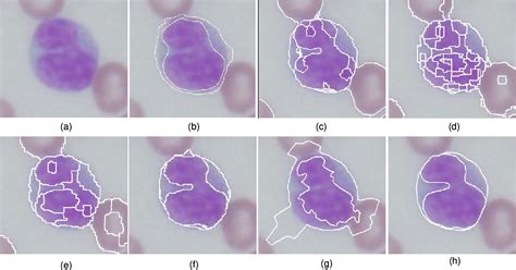 Figure 1 From Unsupervised Segmentation Based On Robust Estimation And Color Active Contour