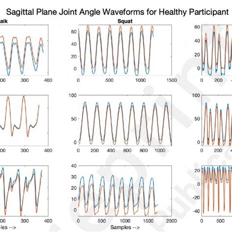 Representative Transverse Plane Joint Angle Waveforms From The Healthy