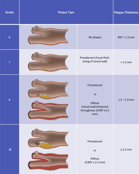Recommendations For The Assessment Of Carotid Arterial Plaque By