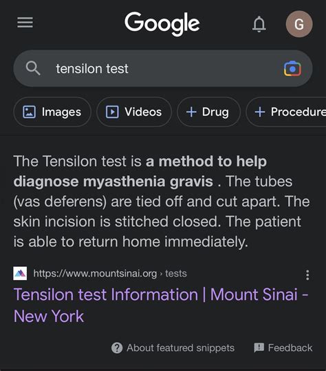 Skin Biopsy And Quantitative Sudomotor Axon Reflex Testing In Patients With Postural Orthostatic