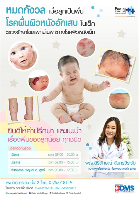 รู้ทันโรคผื่นภูมิแพ้ในเด็ก โรงพยาบาลเปาโล Paolo Hospital