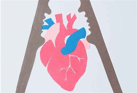 What Is Vasospasm Klarity Health Library