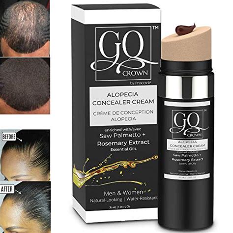Hairline Shadow Thinning Balding Scalp Concealer Topical Shader The