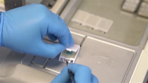 [video] Cellpath A Statlab Company On Linkedin Embedding Needle Core