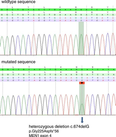 Sequencing Of The MEN Gene Sequence Analysis Of Exon Of The Download Scientific Diagram