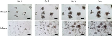 Comparison Of Growing Mouse Small Intestinal Organoids In Matrigel And