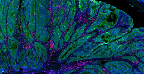 Immunofluorescence Siolas Lab
