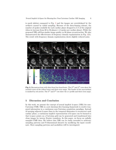 Neural Implicit K Space For Binning Free Non Cartesian Cardiac Mr Imaging Deepai