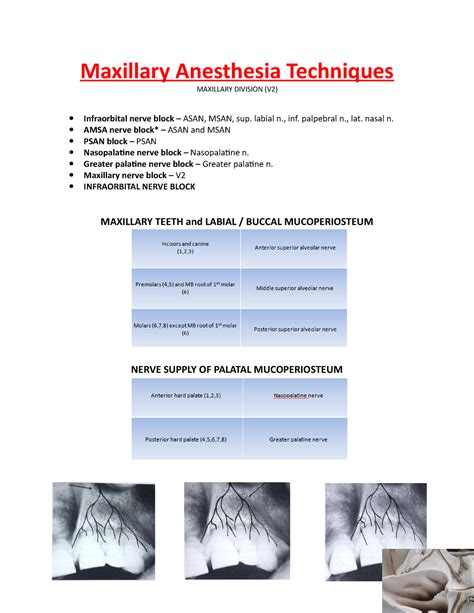 Maxillary Anesthesia Techniques Maxillary Anesthesia Techniques