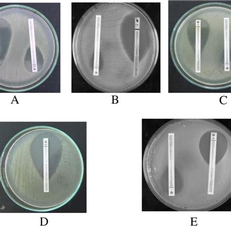 Representative Image Of Susceptibility Of Vibrio Cholerae Against O129
