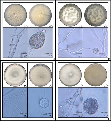 Table 2 From Isolation And Identification Of Phytophthora Sp And