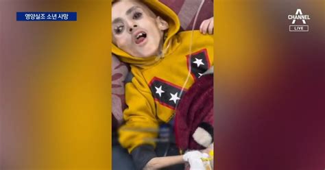 뼈만 남은 가자지구 소년 시신물건너 간 휴전