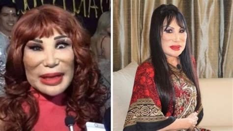 Lyn May Impacta Al Mostrar Lo Espectacular Que Lucía Antes De Que El Cirujano La Deformara