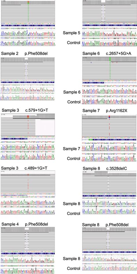 Variant Visualization Using Igv And Mutation Surveyor The Variants For Download Scientific