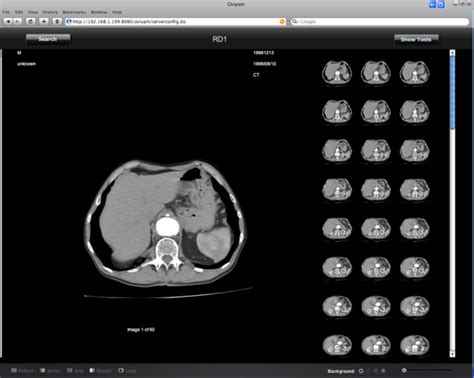 oviyam dicom web browser 0 6 release
