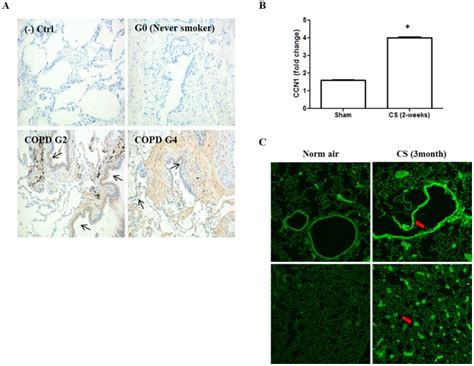 a ihc staining for ccn1 expression in human lung tissue obtained from
