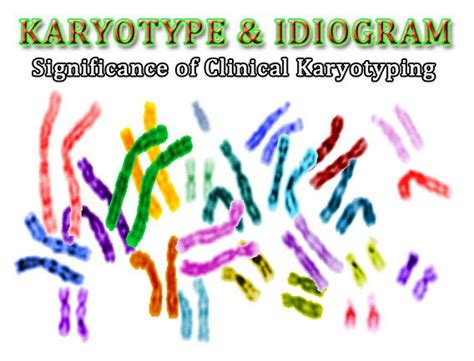 Karyotype Analysis Of Human Chromosome Easybiologyclass