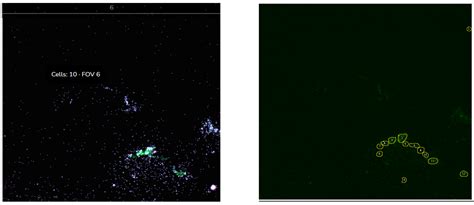 Understanding Cell Segmentation A Key Tool In Spatial Imagi