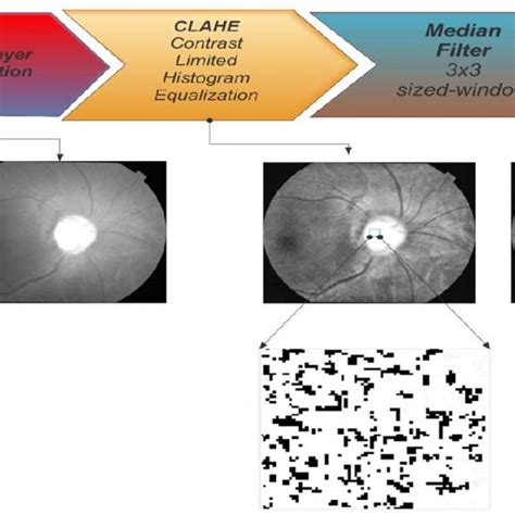 Pre Processing Steps A Red Layer Output B Clahe Output C Download Scientific Diagram